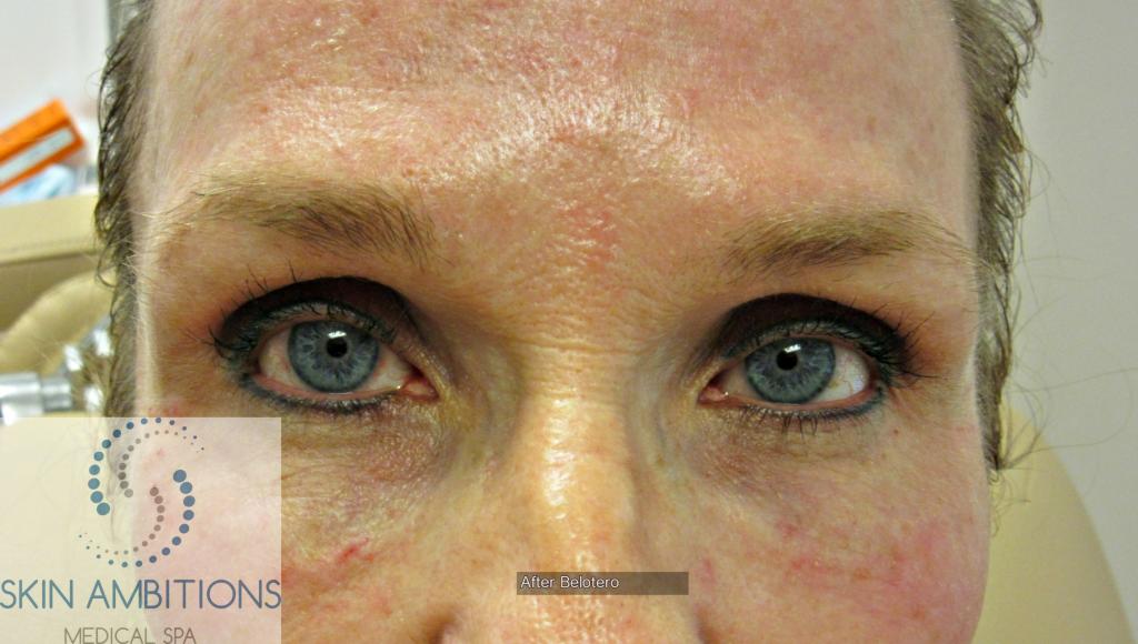 Eyes | Skin Ambitions