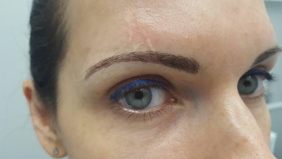 Medical Micropigmentation | Skin Ambitions