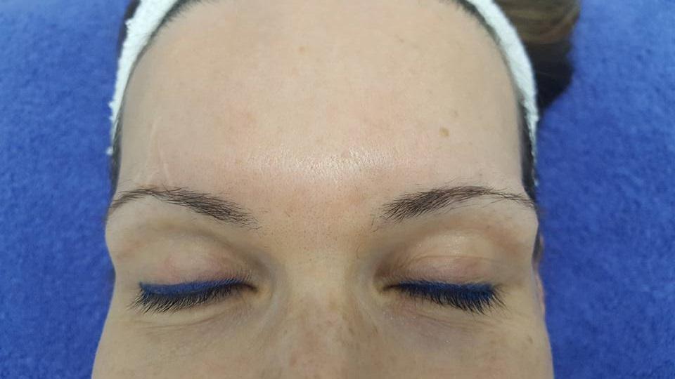 Medical Micropigmentation | Skin Ambitions