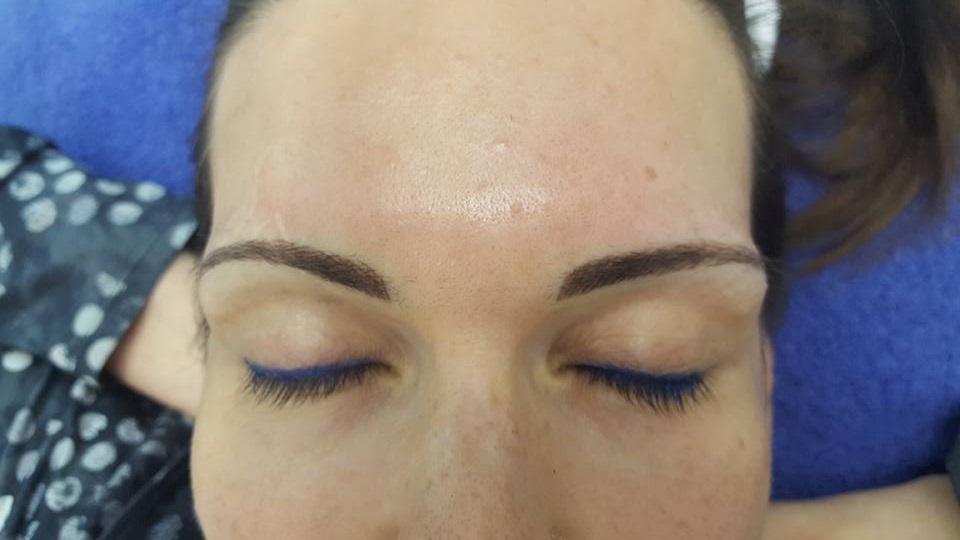 Medical Micropigmentation | Skin Ambitions